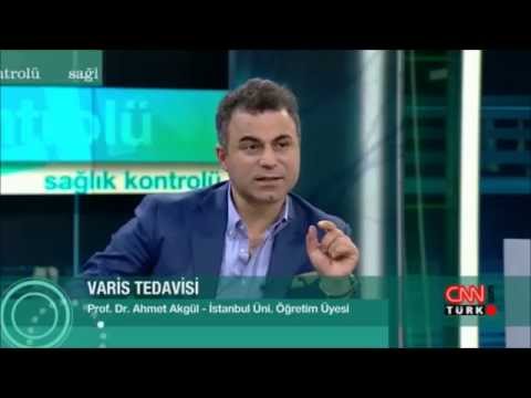 Yanlış ve Eksik yapılan VARİS Ameliyatları ve VARİS Tedavileri - Prof. Dr. Ahmet AKGÜL