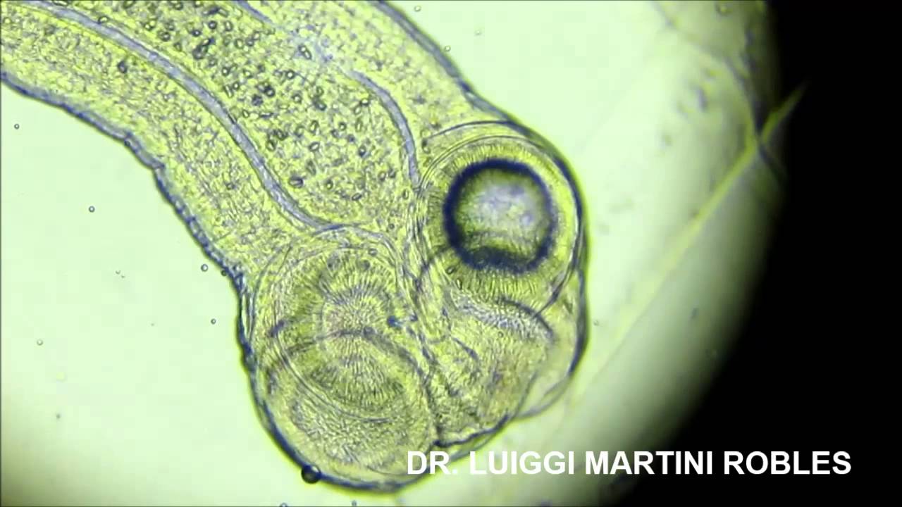 Hymenolepis diminuta - YouTube