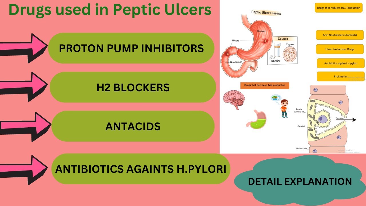 Drugs used in Peptic Ulcers|Pharmacology| #peticulcers #git # ...