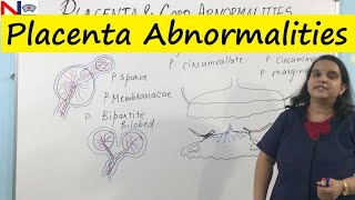 Placenta Spuria