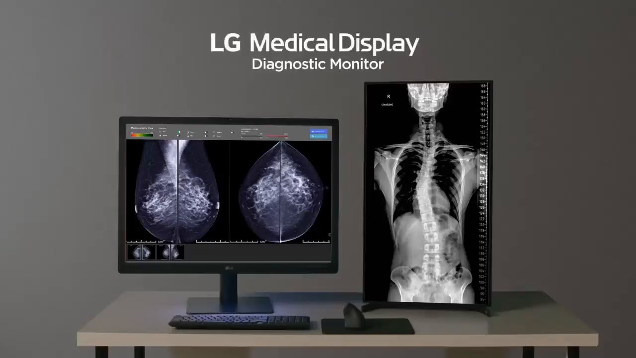 Monitores de Diagnósticos | LG Medical Display - YouTube