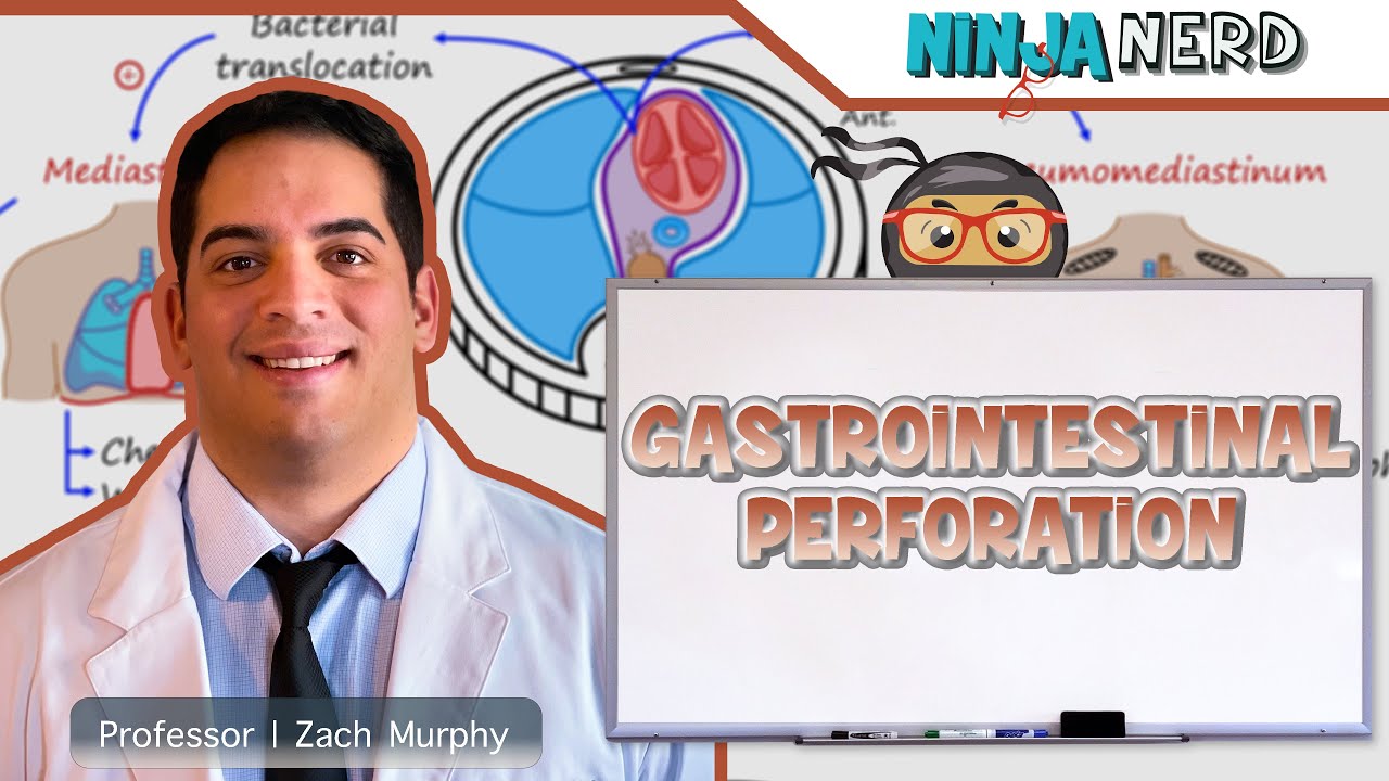 Gastrointestinal Perforation | Clinical Medicine - YouTube