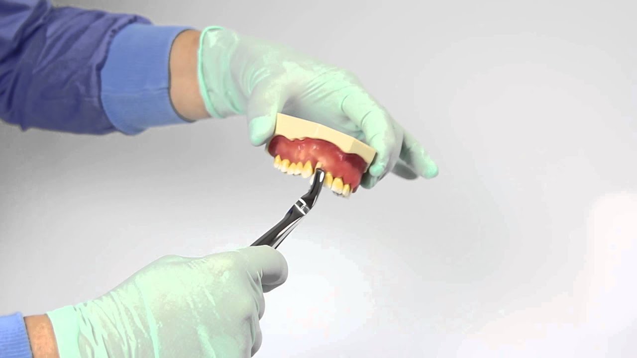 Tutorial 1 Extracting Forceps Youtube 2103
