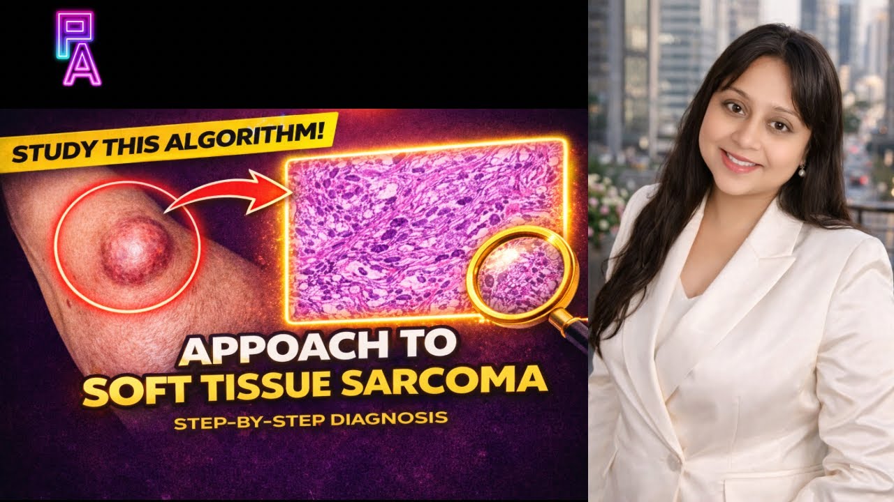 APPROACH TO SOFT TISSUE SARCOMAS| BY DR.ADITI KUMAR - YouTube