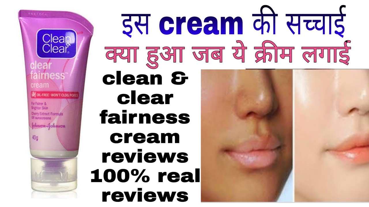 Clean and clear fairness cream reviews | teenage girl cream clean and ...