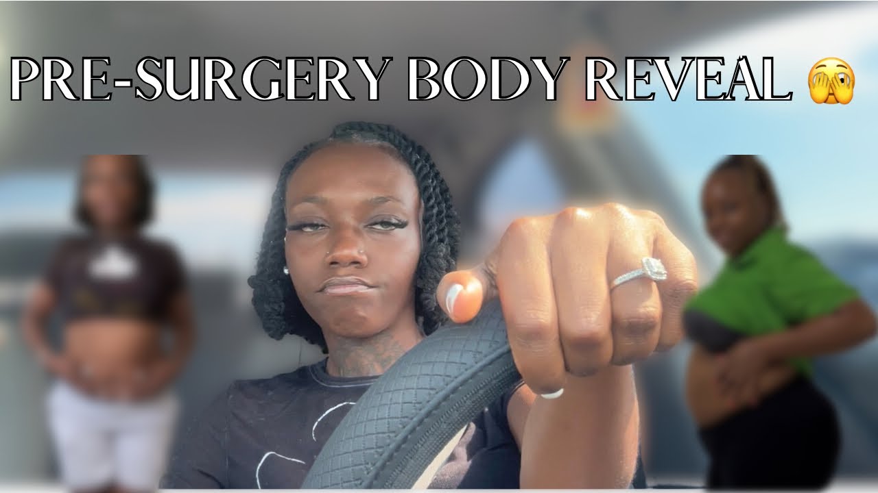Last minute prep before preop | 1 DAY until lipo/360 & BBL | PRE ...