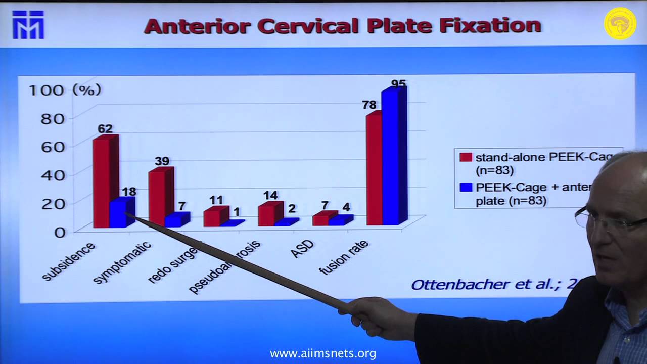 Anterior Cervical Fixation: Cage Stand-alone Vs Cage + Plate fixation ...