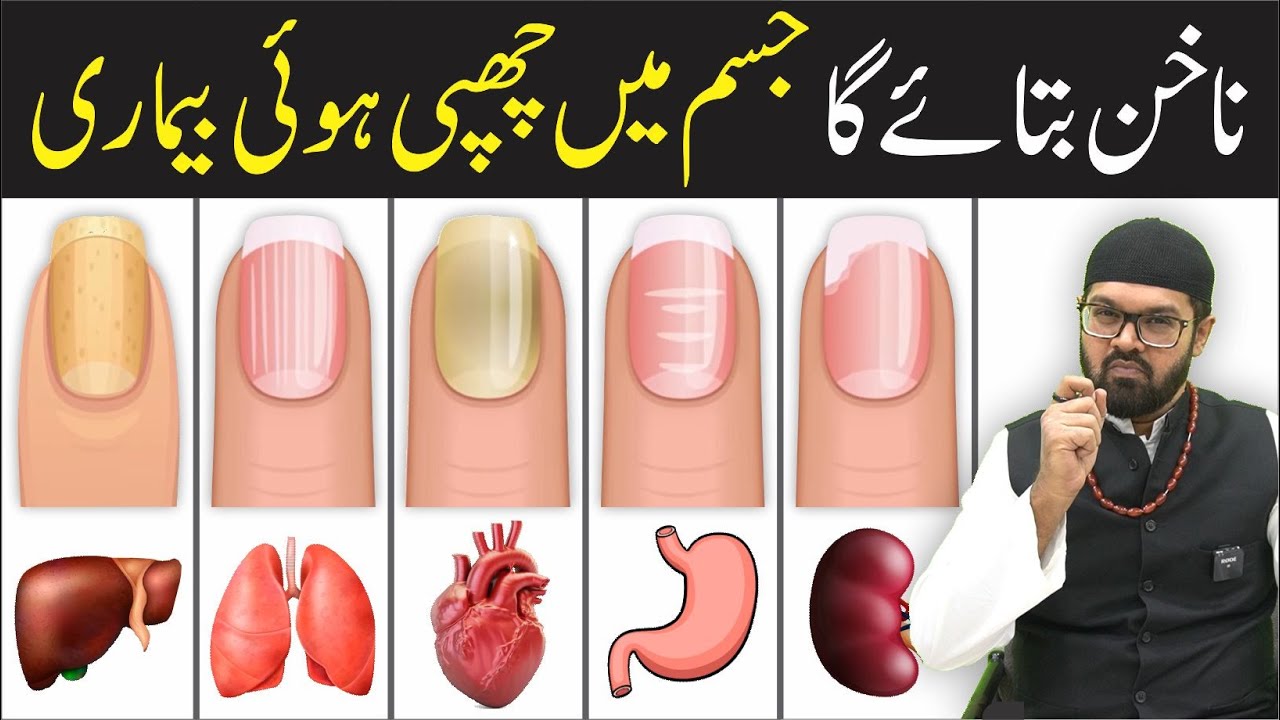 Nakhun Bataye Bimari | Dr. Fahad Artani Roshniwala | Roshni Centre ...