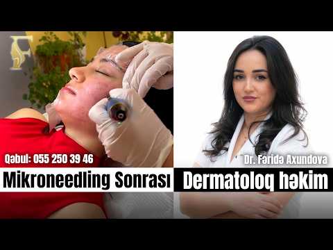 Mikroneedling – Ləkə və Çapıq Müalicəsi