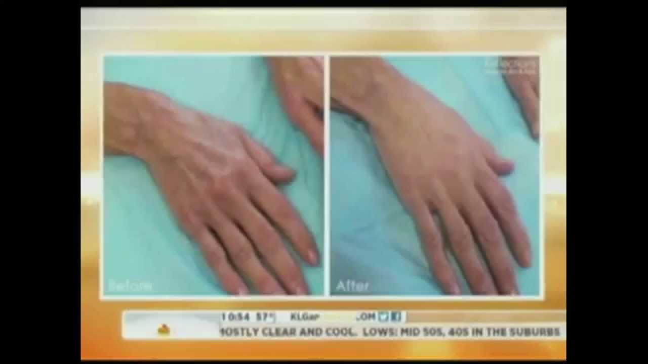 Improves textural irregularities and more - Pittsburgh Pa - YouTube