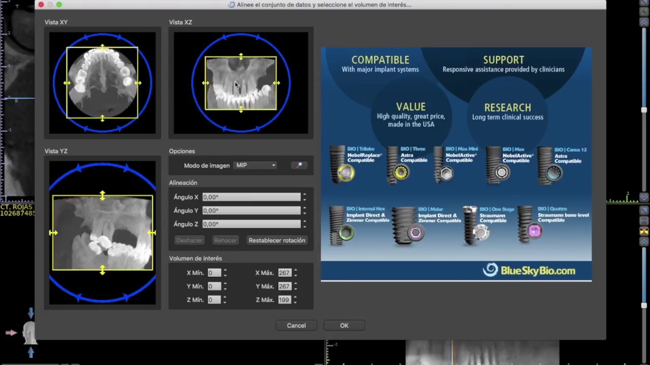 tutorial 1 Blue Sky Plan en español Abrir archivos dicom y presentación ...