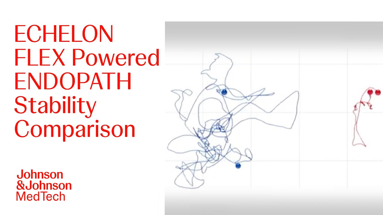 Comparing Stability of Powered vs Non-Powered Stapling Systems: ECHELON ...