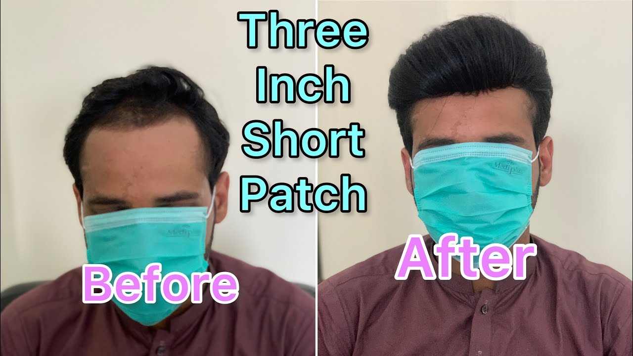 Information Three inch short hair patch - YouTube