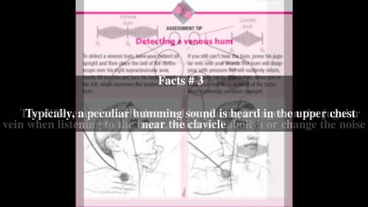 Venous hum Top # 6 Facts - YouTube