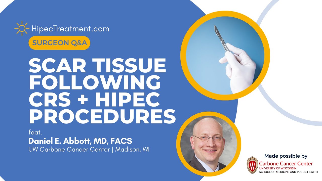 Scar Tissue Following CRS + HIPEC | Surgeon Q&A w: Daniel Abbott & Syed ...
