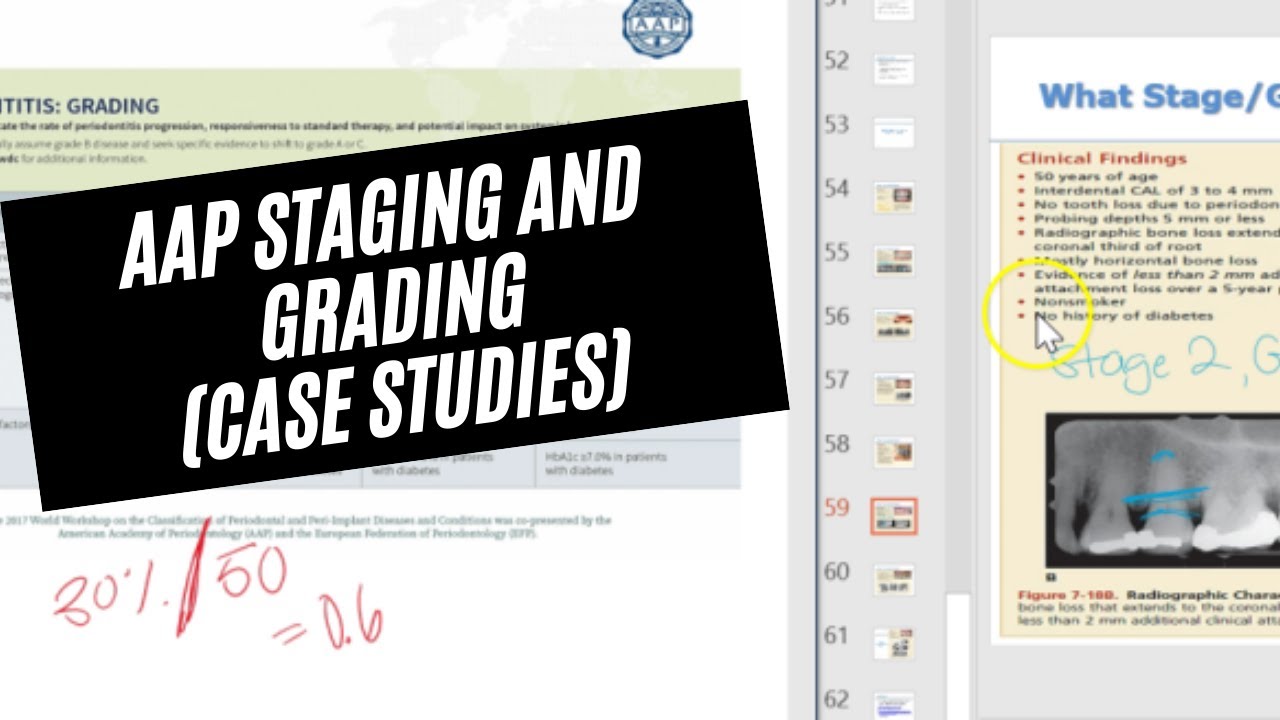 AAP Staging and Grading - Case Studies - YouTube