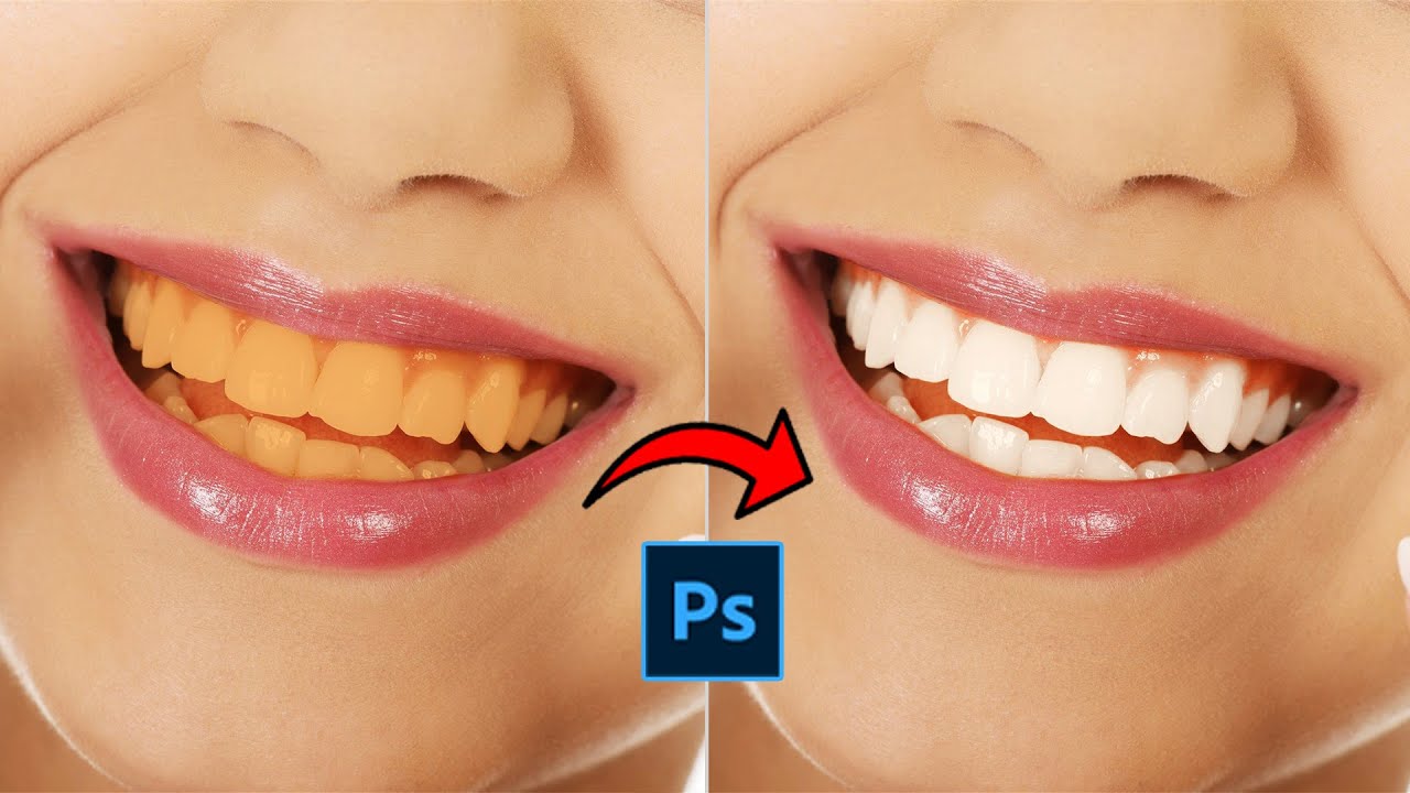 How to Yellow to Whiten Teeth in Photoshop 2024 | Tutorial For Beginner ...