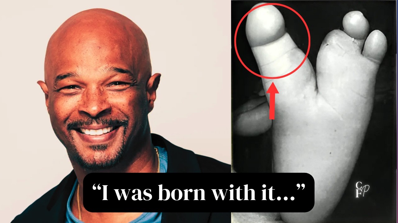 10 Hollywood ACTORS ... With Weird Body Deformities! - YouTube