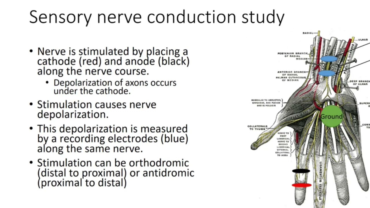 UT Southwestern Neurosurgery Faculty Lecture Series: Russell Payne, M.D ...