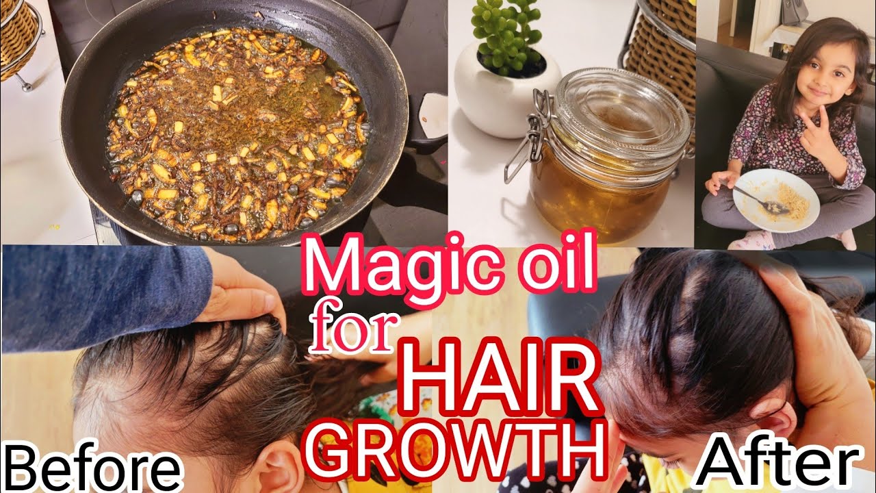 1 Magic hair Grouth oil for kids and adult ️ 😍 | LIVE Proof hail oil ...