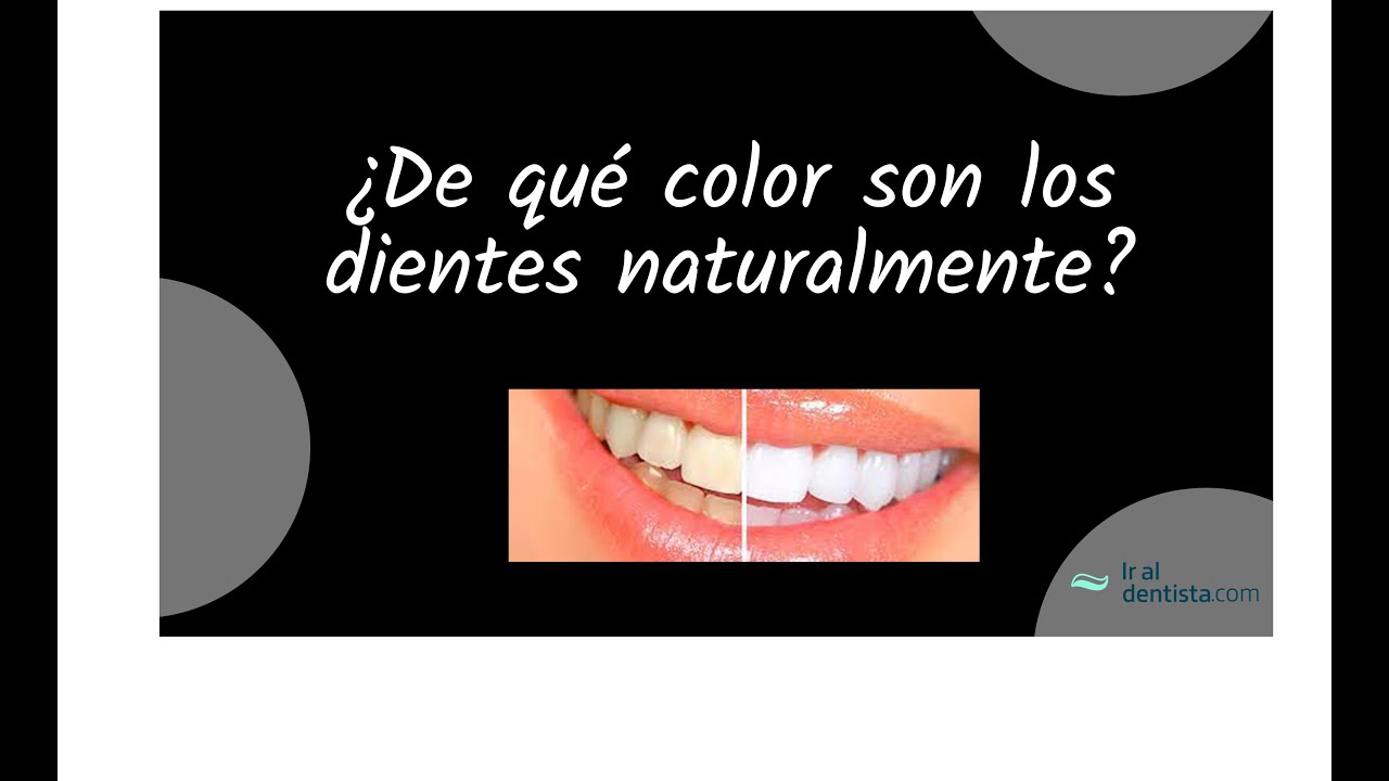 ¿De qué color tienen que ser mis dientes? - YouTube