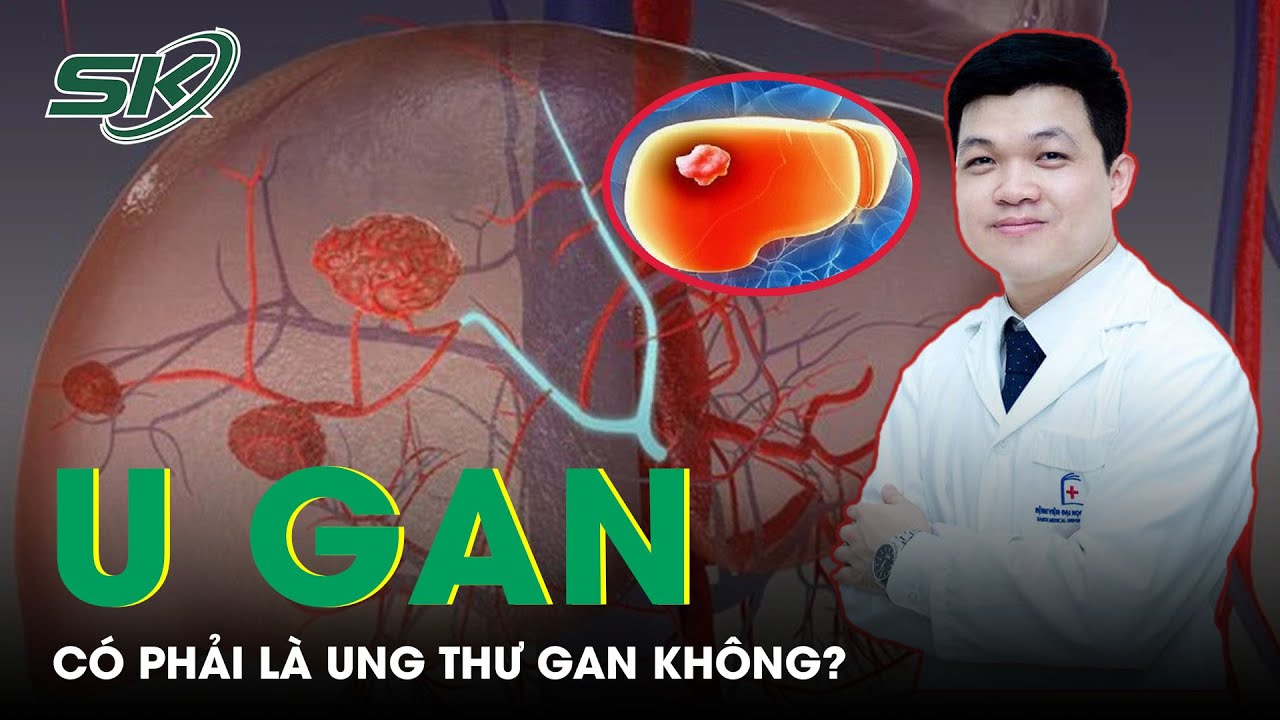 U Gan Có Phải Là Ung Thư Gan Không? | SKĐS - YouTube