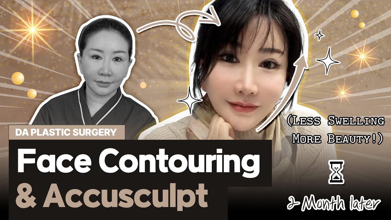 [Plastic Surgery Korea] Best Revision Face Contouring Results You can ...