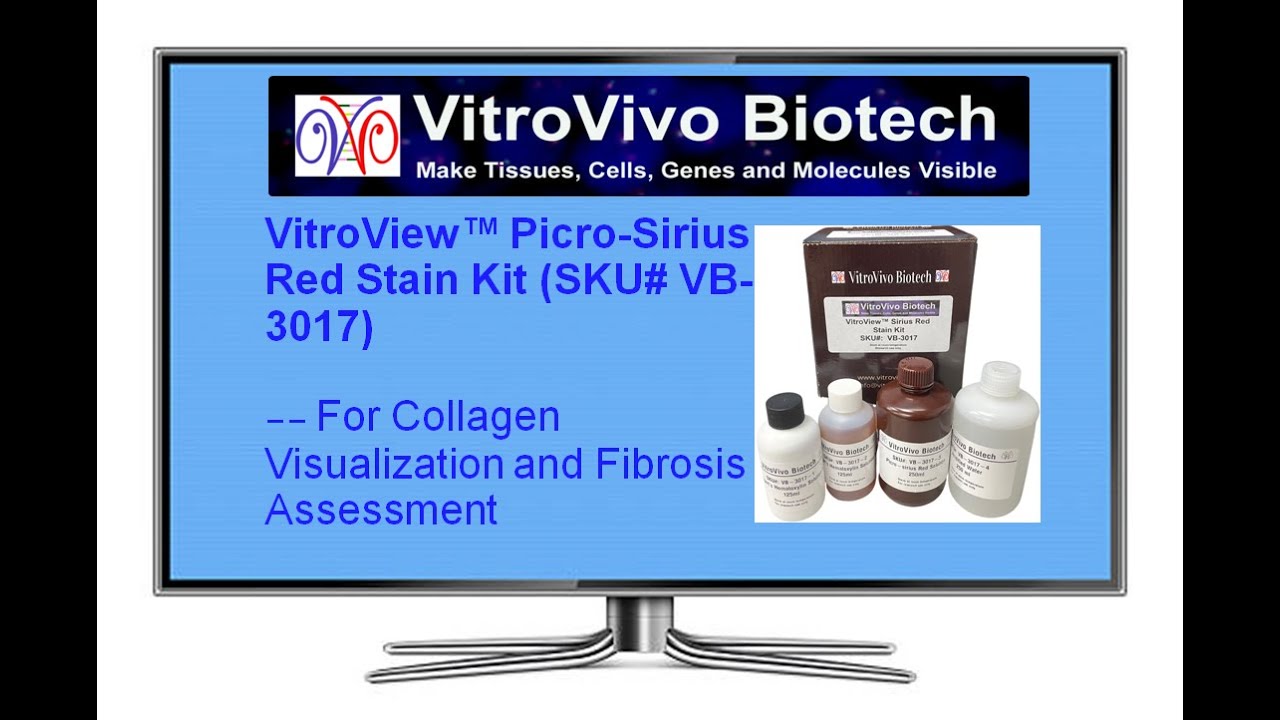 VitroView™ Picro Sirius Red Stain Kit and Protocol (Video) - YouTube