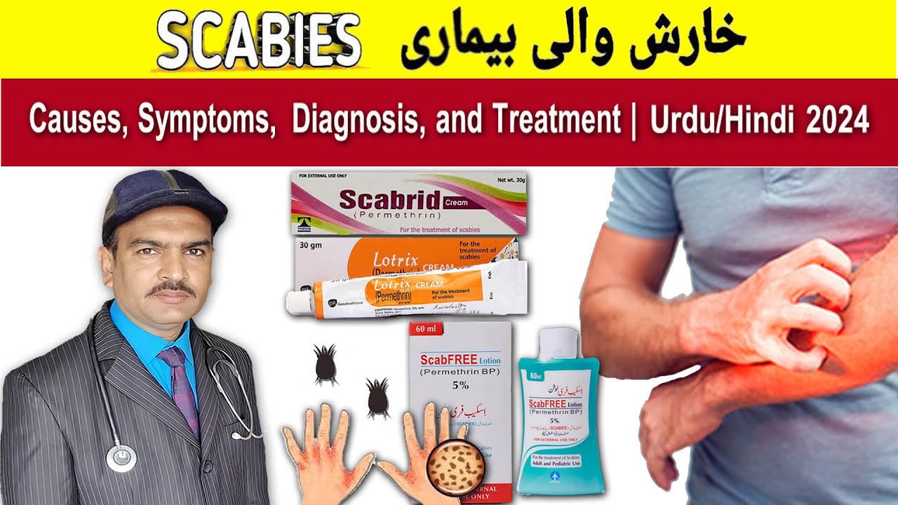 Scabies in Urdu/ Hindi || Causes, Symptoms, Diagnosis, and Treatment ...