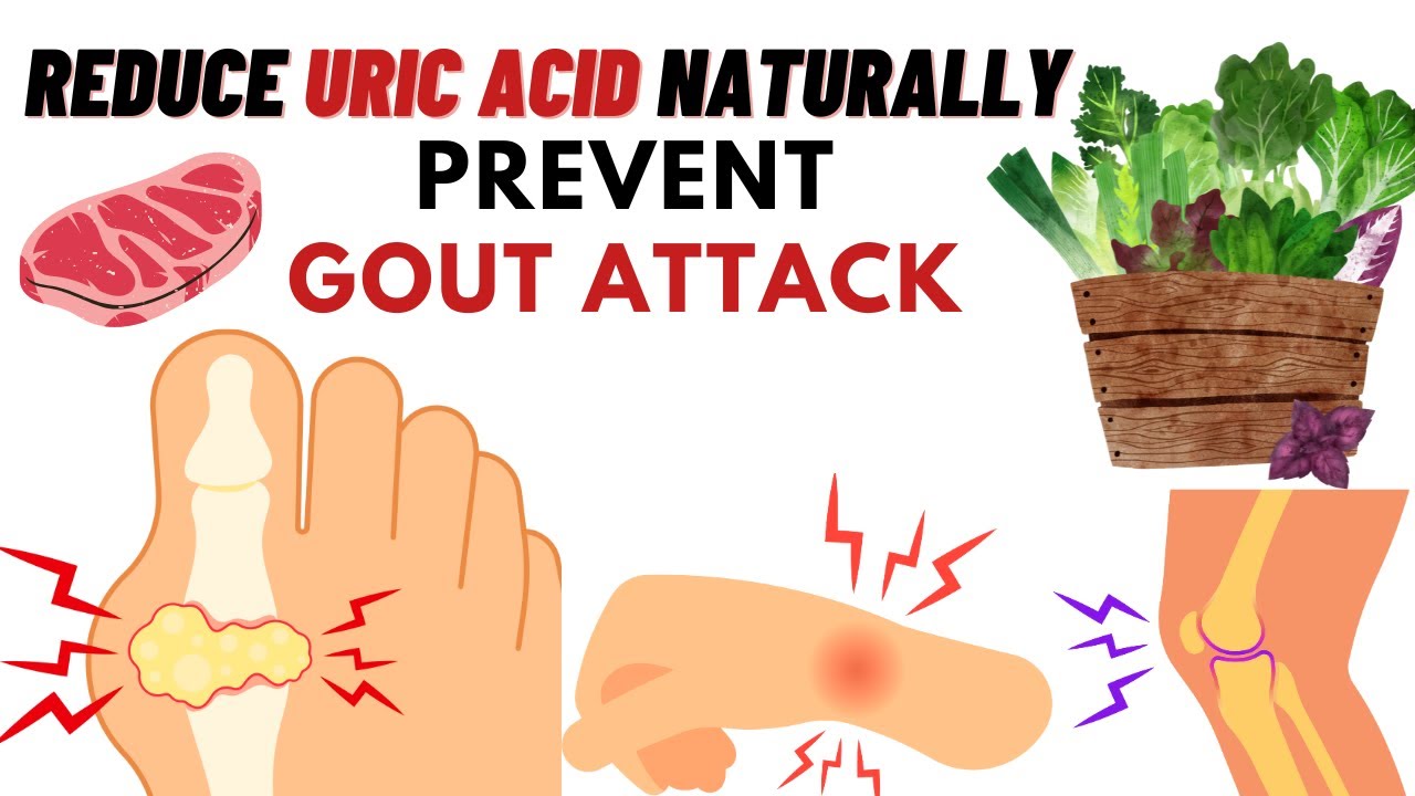 Best Home Remedies For Uric Acid - YouTube