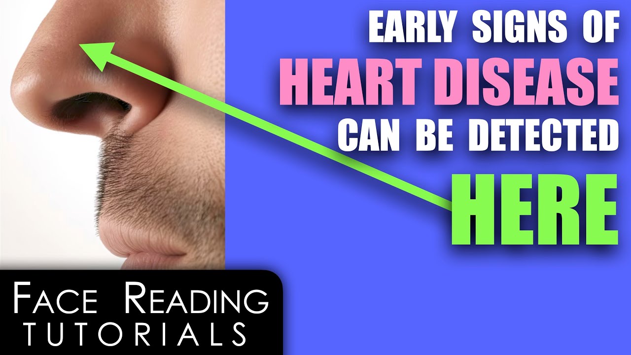 How Your Nose Can Show You Early Signs of Heart Disease - YouTube