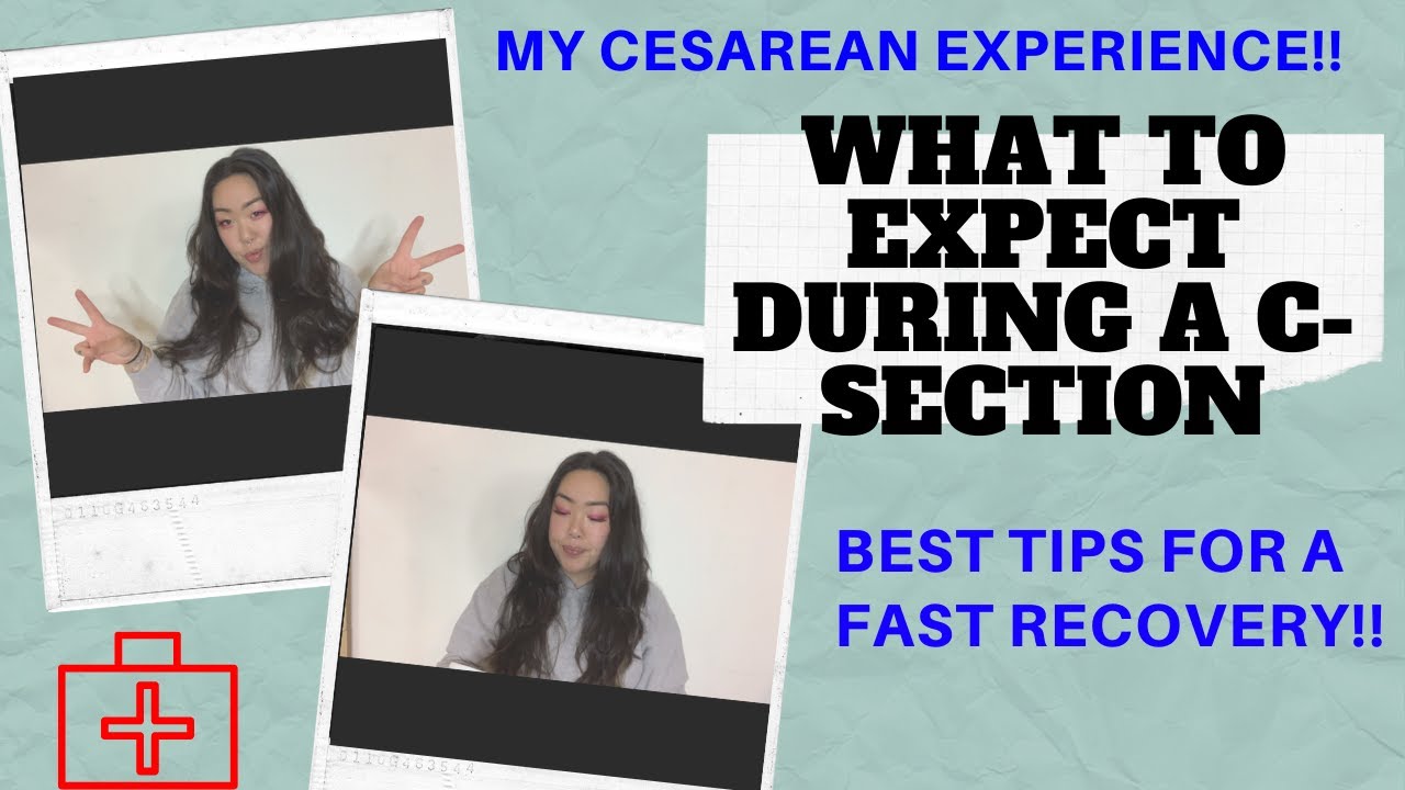 WHAT TO EXPECT DURING & AFTER A C-SECTION | BEST RECOVERY TIPS [My ...