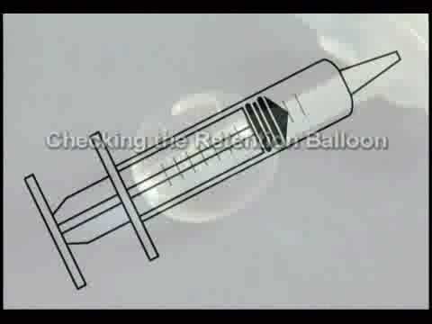 Everyday Care of the MIC-KEY* Feeding Tube - YouTube