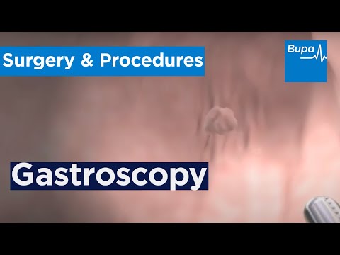 How a gastroscopy is carried out | Bupa Health