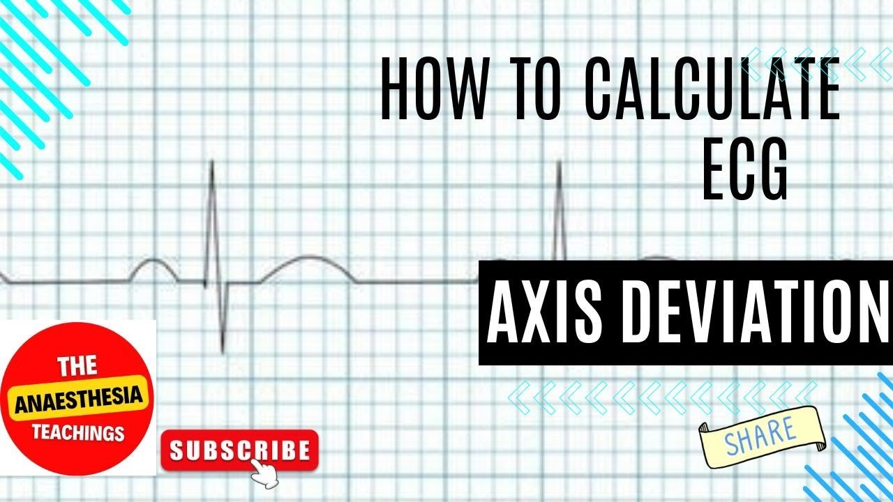 LEAKED !! A very easy way to calculate Axis determination in #ECG #hacks #axisdeviation # ...