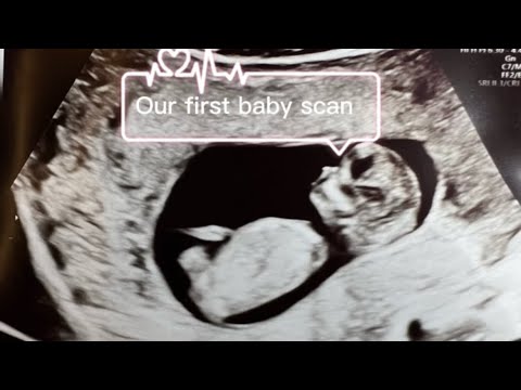 OUR FIRST BABY SCAN!! ♡ - YouTube