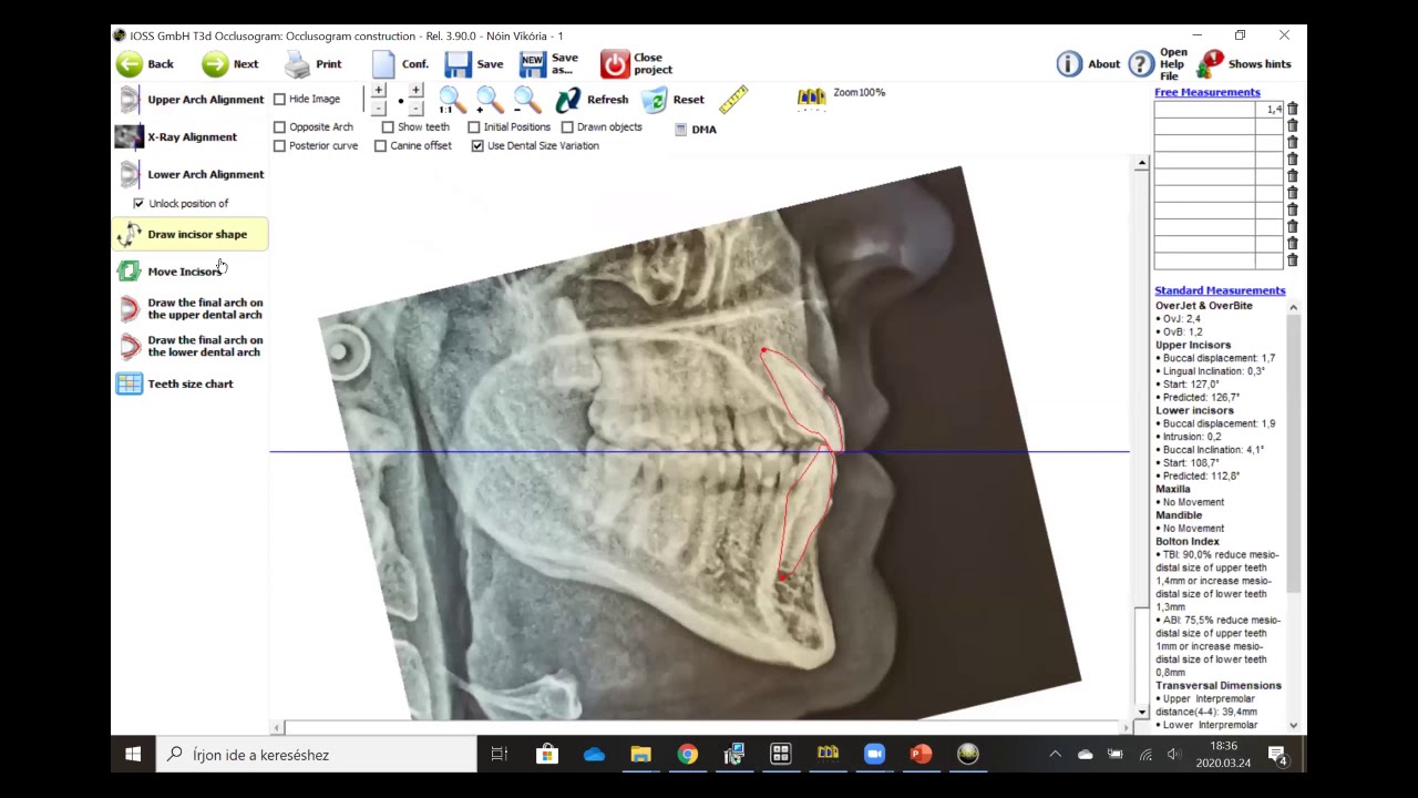 Clinical discussion treatment plan - YouTube