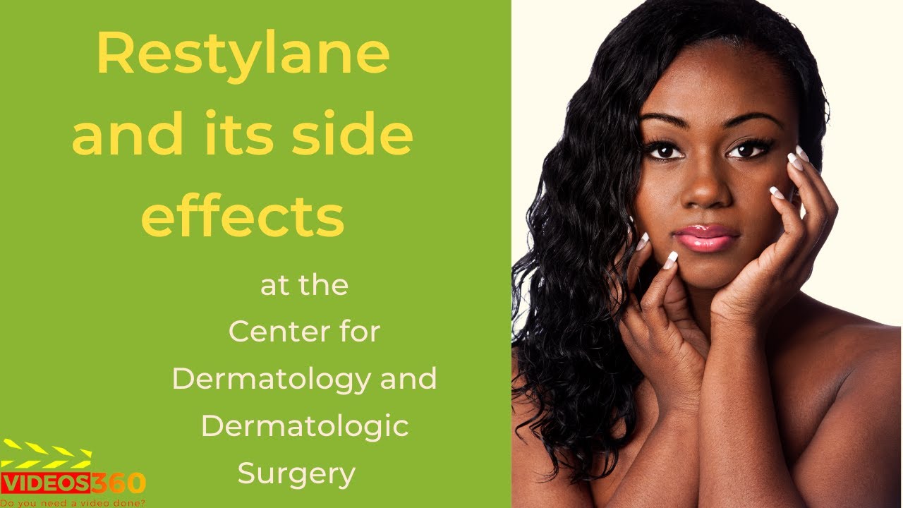 What is Restylane and it's side effects? Explained by Dr. Cheryl ...