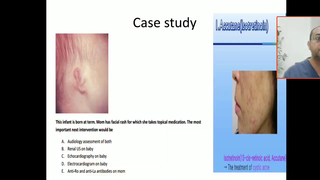 Case 70 teratogenic medication, isotretinoin embryopathy, retonic acid ...