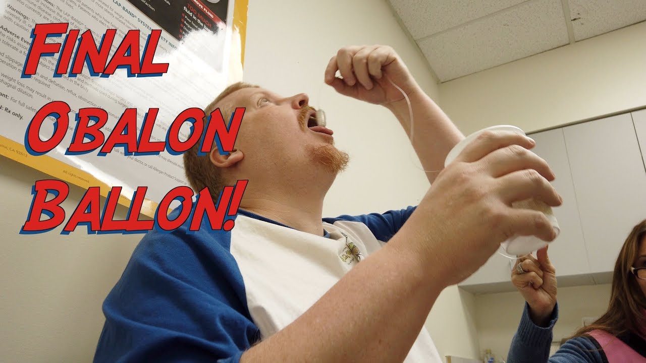 My 3rd and final Obalon Gastric Balloon - YouTube