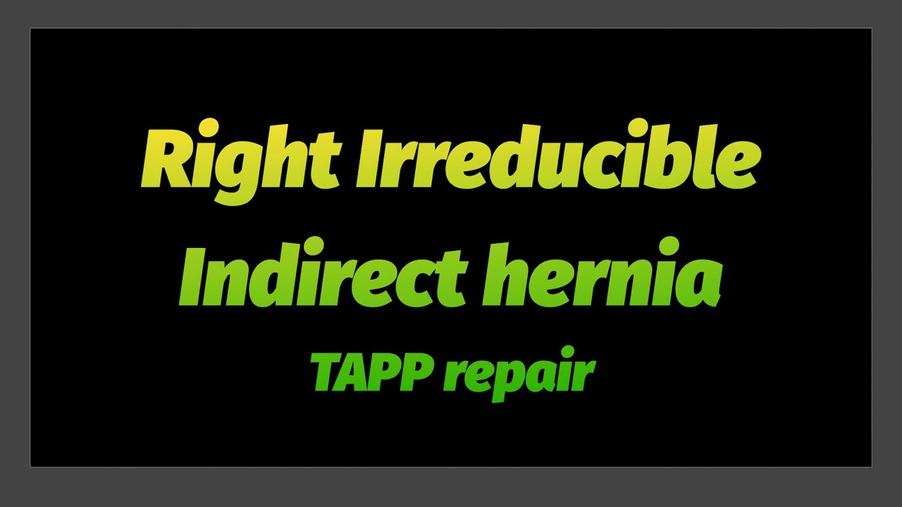 4. Right irreducible indirect hernia - TAPP repair - Dr.R.Parthasarathi ...