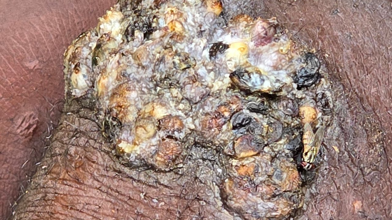 Most jiggered knee - watch long video @riseupsociety.net ($9.99) - YouTube