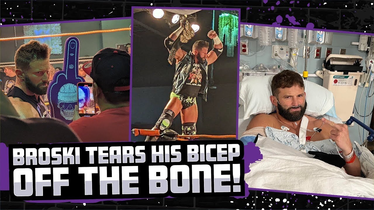 Broski Tears His Bicep From The Bone - YouTube