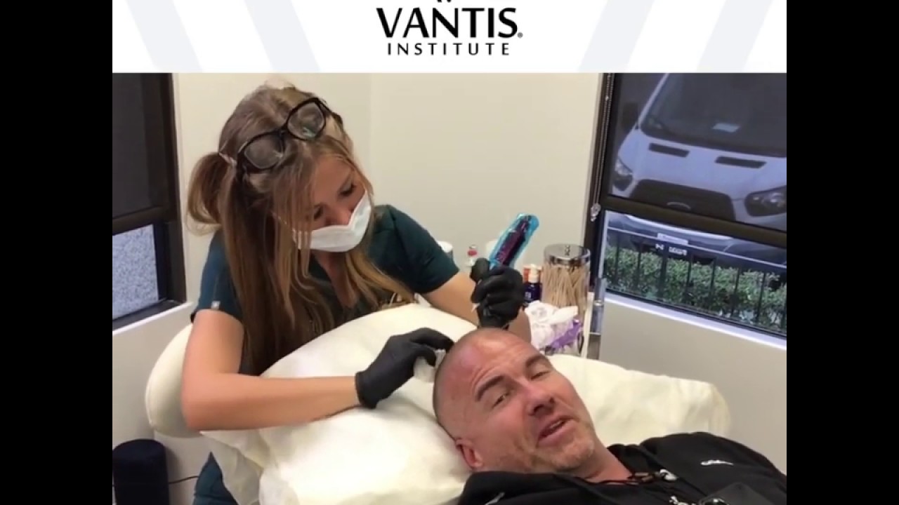 Jay Campbell talks about his Vantis Follicle Replication™ Treatment ...