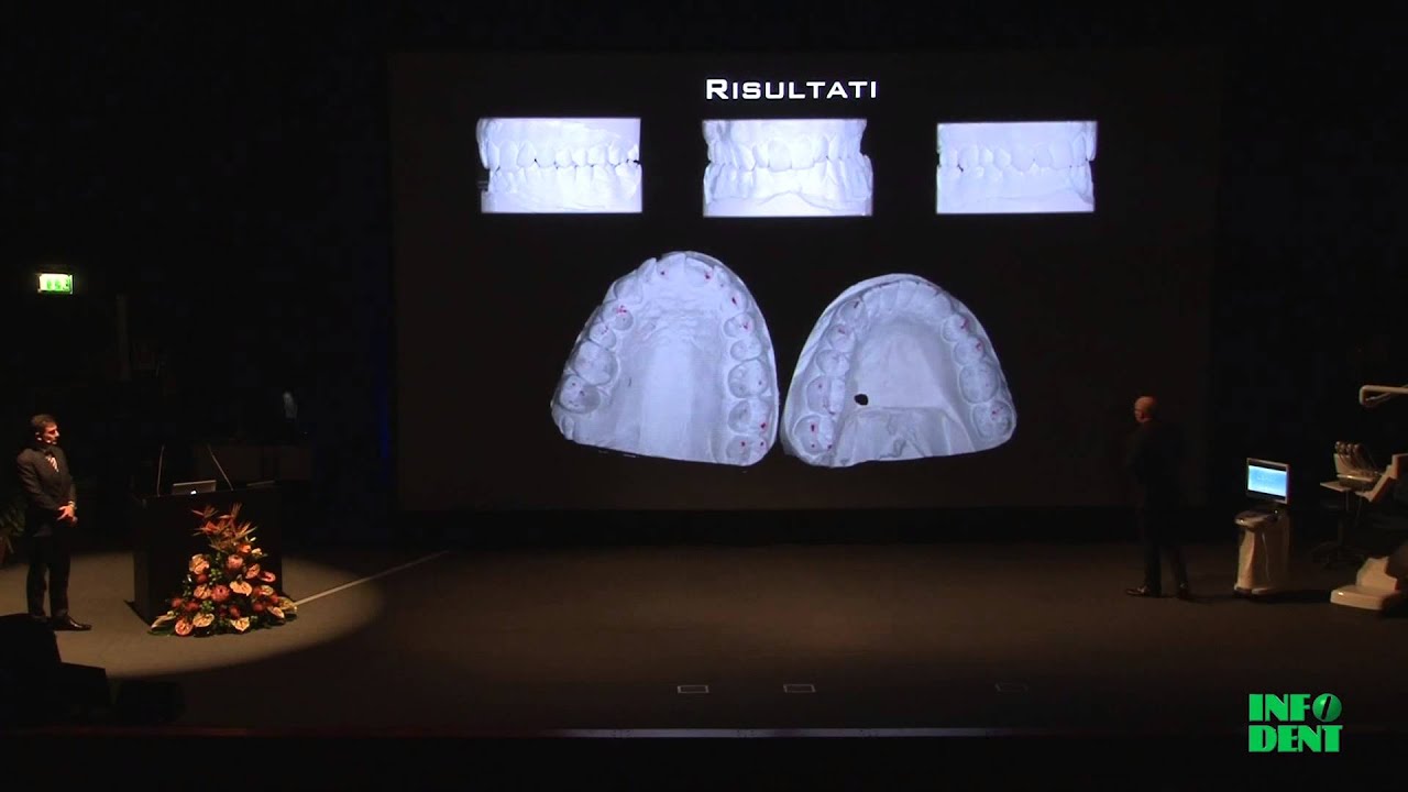 II° Sirona Users Meeting - Dott. Carlo Raimondo - YouTube