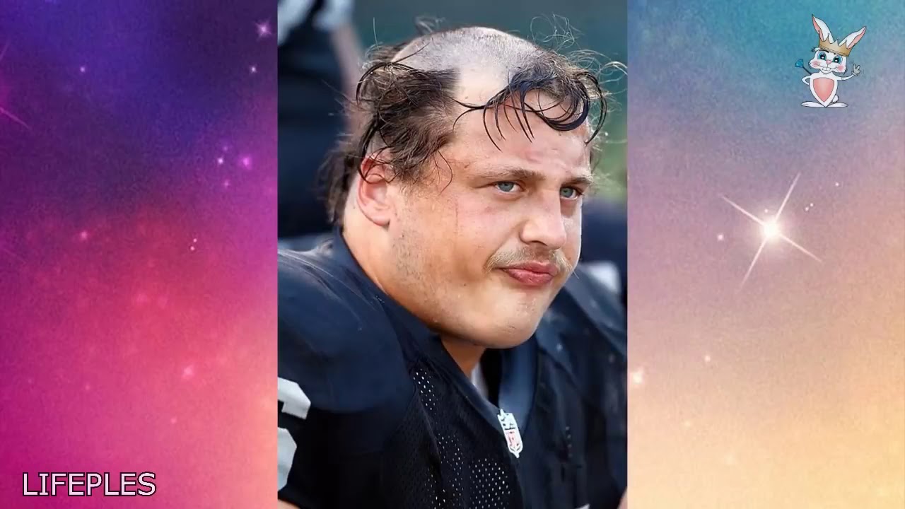 hairline funny moments🍇🍇🍇🍇🍇🍇 - YouTube