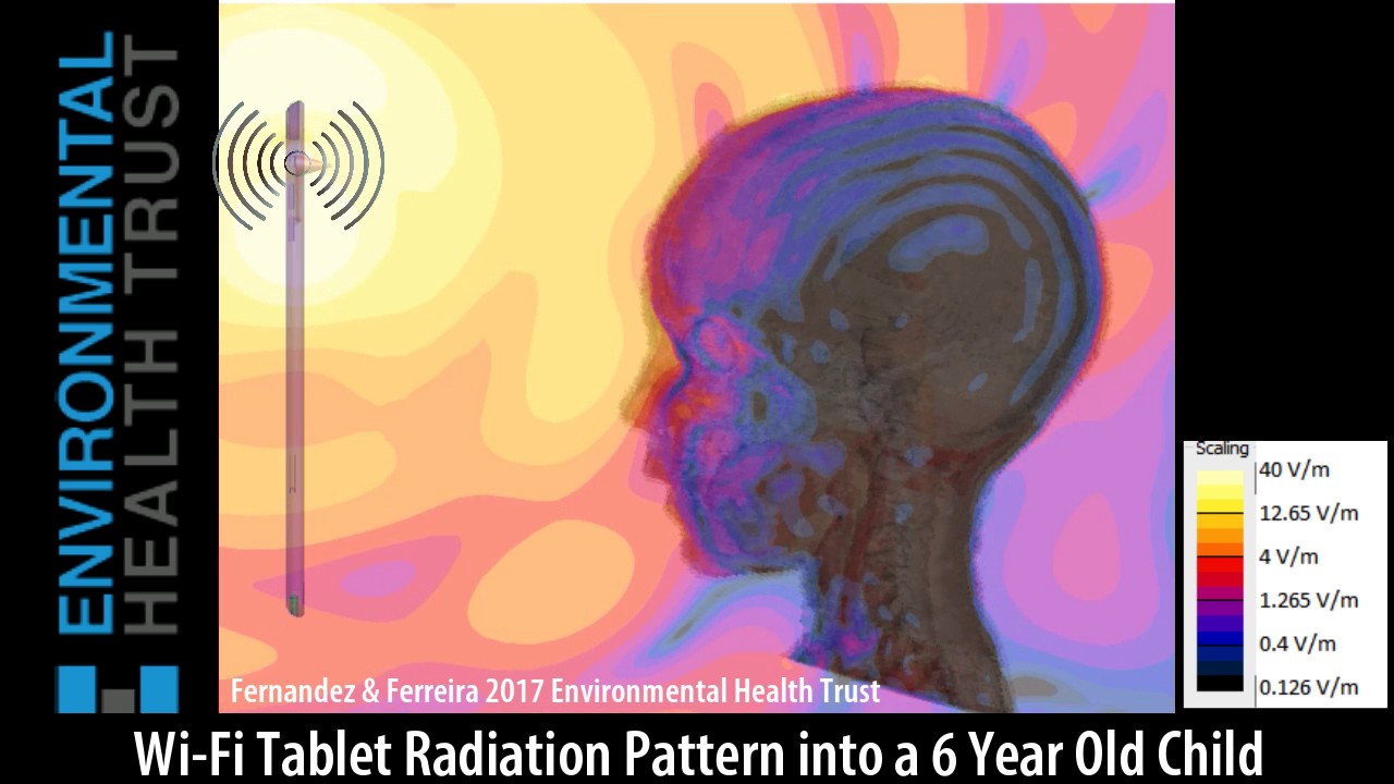 Wi-Fi Tablet Radiation Into a 6 Year old Child- #shorts #shortsyoutube ...