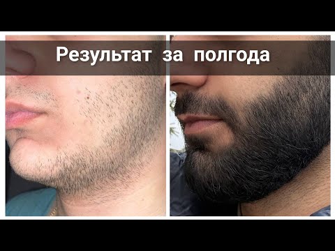 Лосьон для роста волос и бороды. К густой бороде за полгода. 