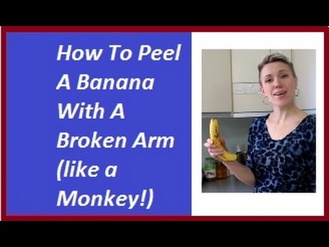 Easiest Way To Peel A Banana With Your Broken Arm: Life With A Cast ...