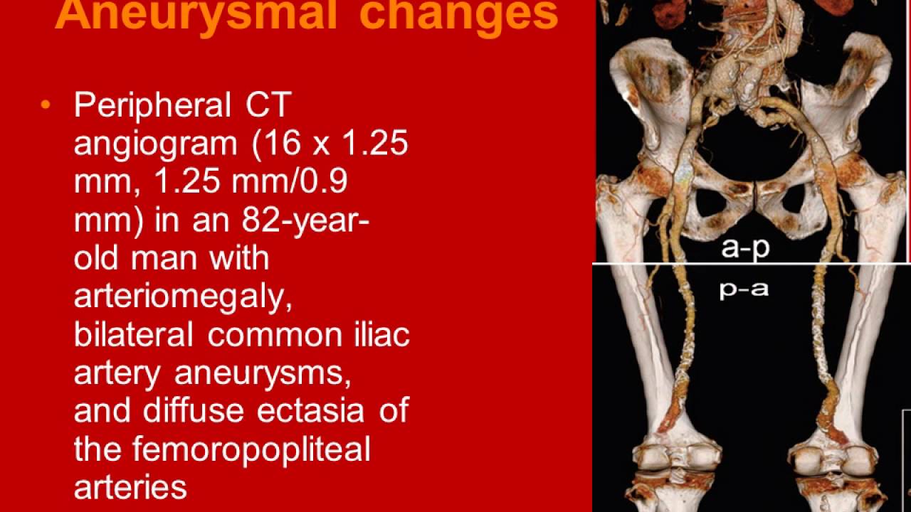 24 Radiology Channel Imaging oral Board of CTA MRA angiography ...